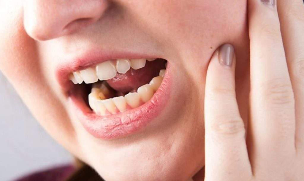 How To Unlock A Locked Jaw Lock Jaw And TMJ Problems