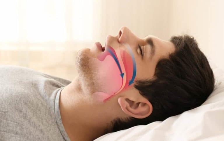 Snoring Clinic Sydney | Treating Sleep Apnea and Snoring