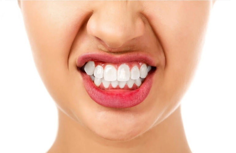 Clenching Teeth While Awake - TMJ and Sleep