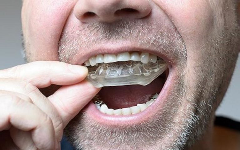 How To Relax Your Jaw | Easy Jaw Exercises for Pain Relief